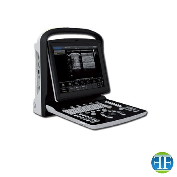 Vendita Ecografo CHISON ECO-3 VET GIMA, Fiandaca Medical